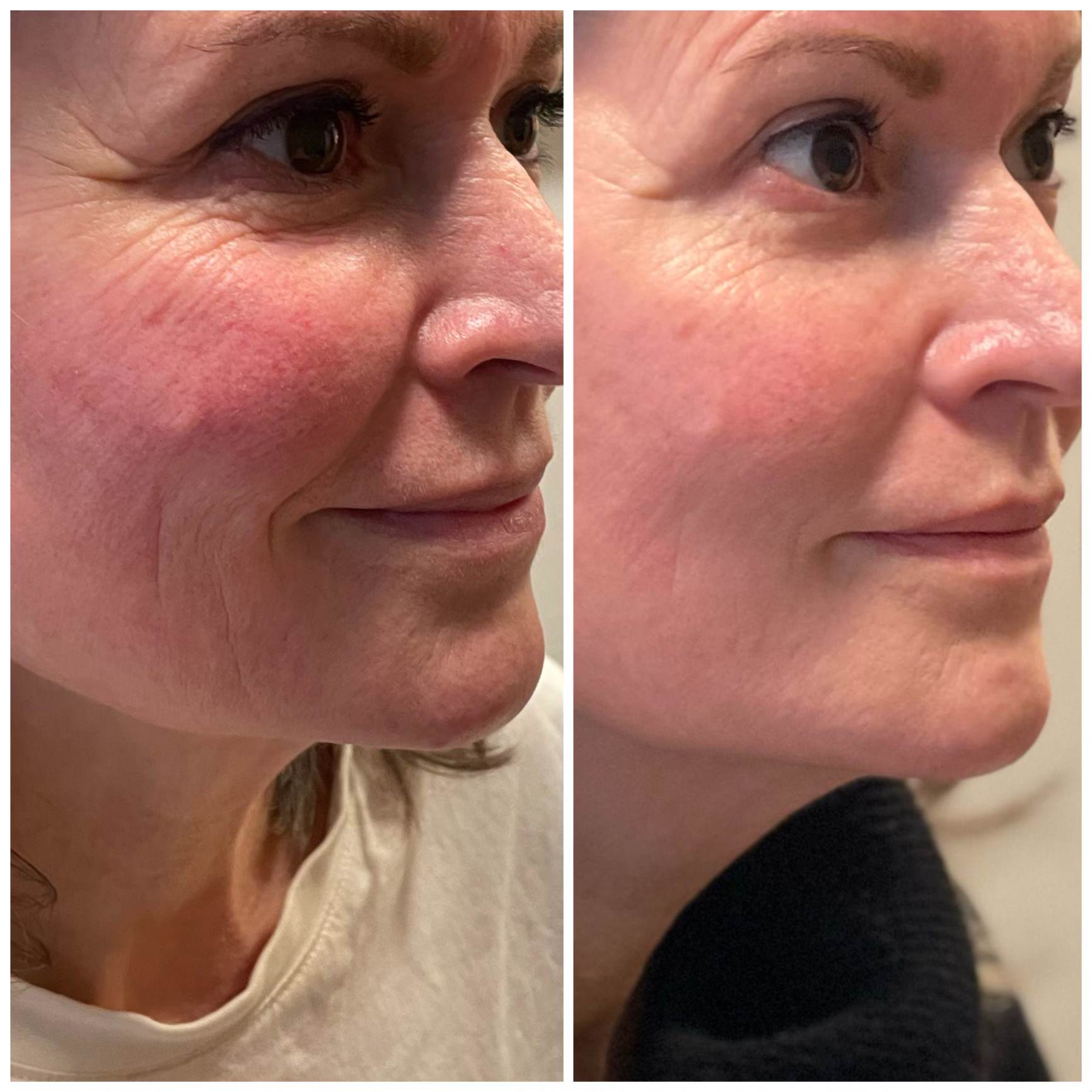 EMS Studio - EM Shaper